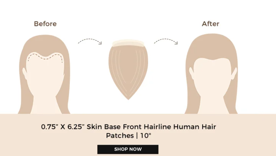 The Art of Lowering Your Hairline with UniWigs Frontal Hair Patch