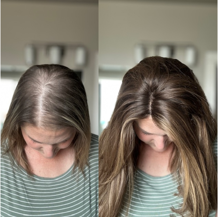 Top Mistakes to Avoid When Choosing and Wearing Hair Toppers