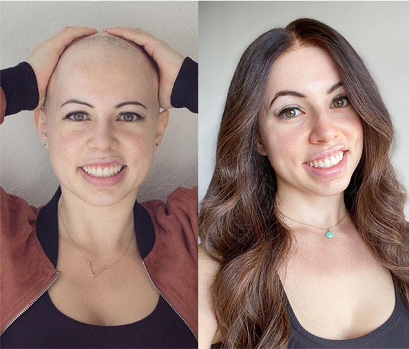 Human Hair Wigs Before And After